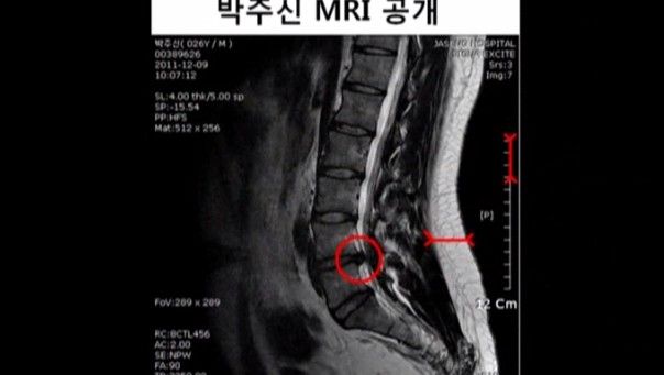 "박 시장 아들 MRI 맞다" 강용석 의원직 사퇴